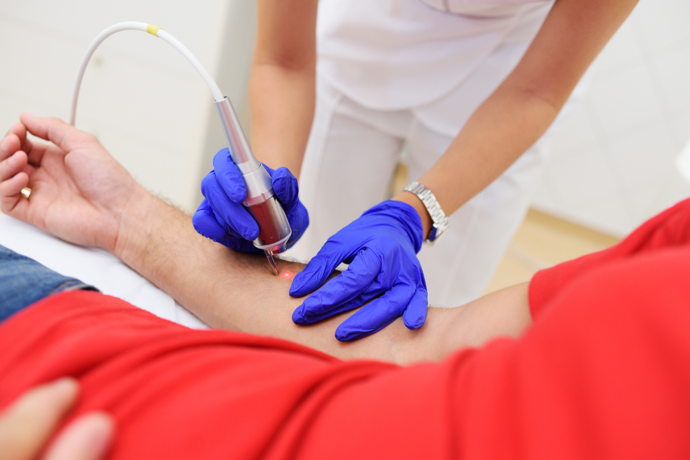 Laser Vein Therapy | Call Us For Your Austin Vein Treatments